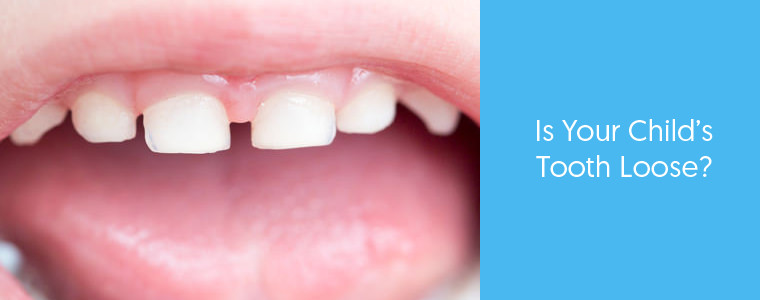 What to do When Your Child Has a Loose Tooth | Dental Aware Australia