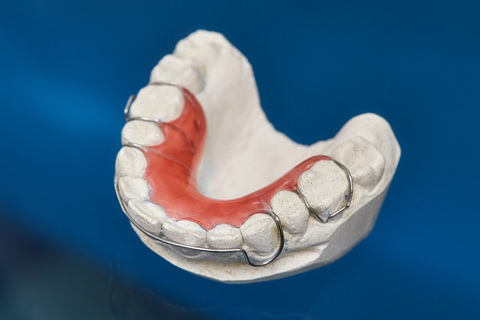 What Is Orthodontic Treatment? | Dental Aware Australia