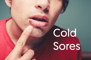 Cold Sores - A Guide to Help | Dental Aware Australia