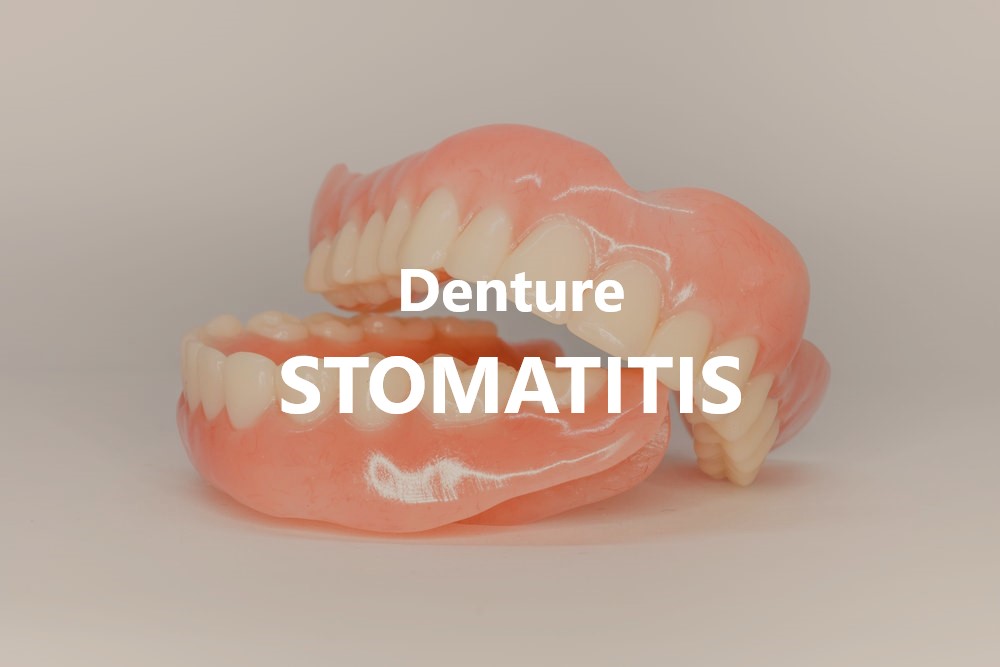 False Teeth - What Are My Options | Dental Aware Australia